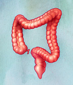 Irritable Bowel Syndrome (IBS) - United Digestive