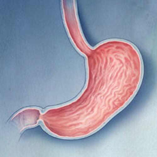 Gastritis - United Digestive