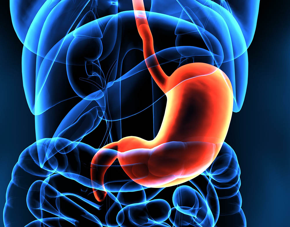 Stomach Cancer United Digestive stomach-cancer-united-digestive